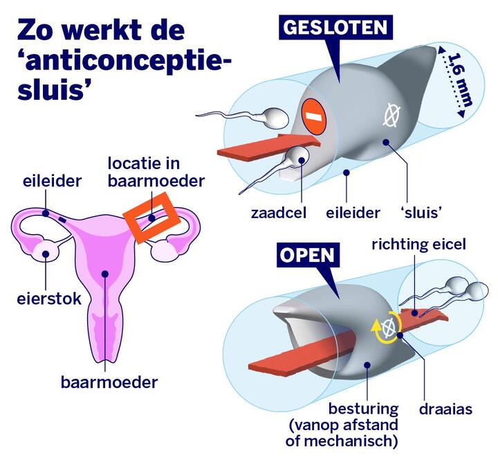 Vlaams bedrijf werkt mee aan revolutionaire anticonceptie: “Uitgekiend ...