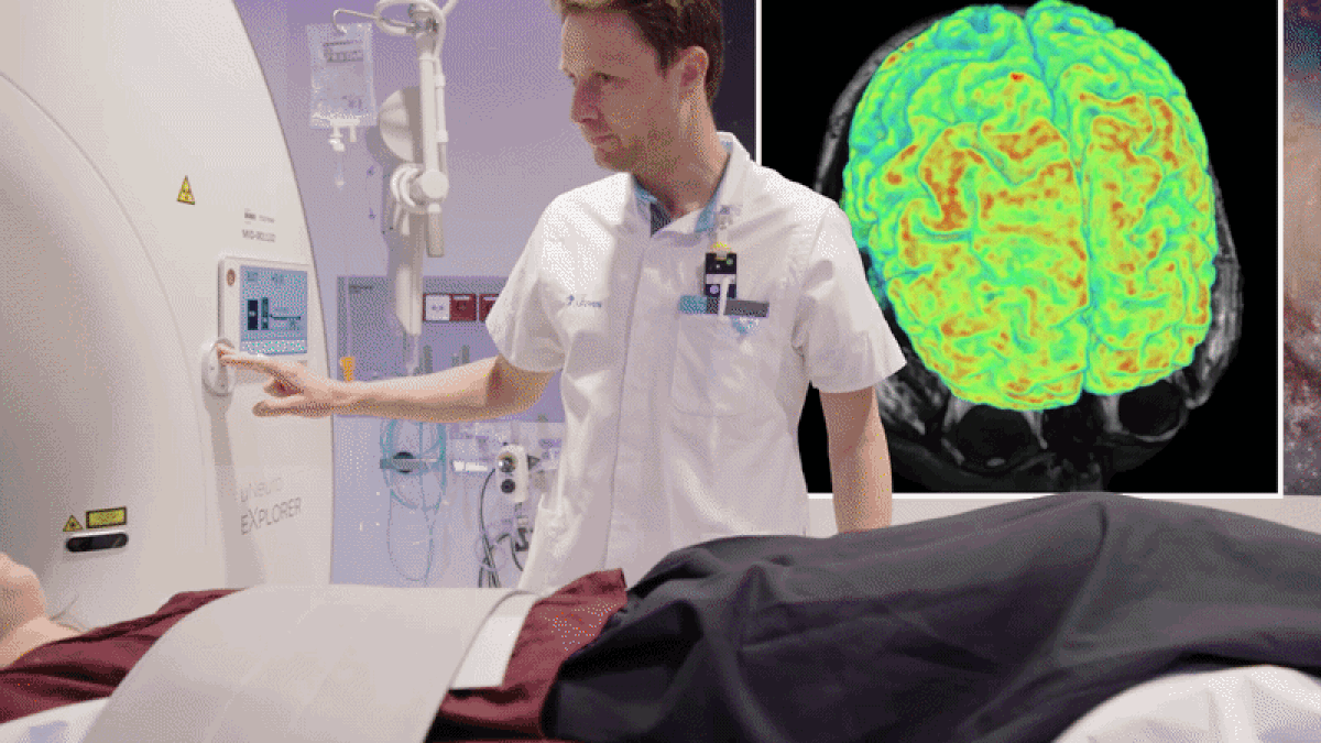 Deze scanner spoort hersenziekten op, jaren voor eerste symptomen ...